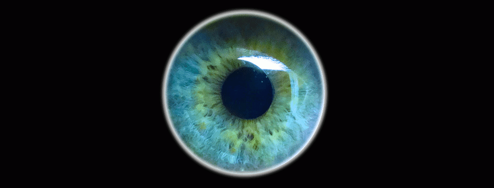 Virtual Reality looks at Lazy Eye - 4Experience VR Studio